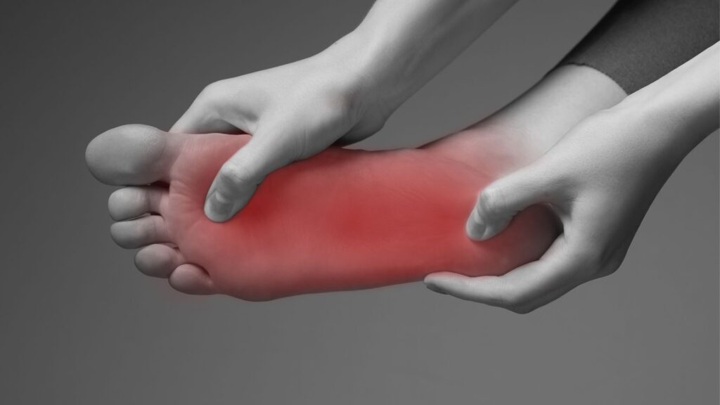What Is a Fallen Arch and How Is It Treated? | Alexander Orthopaedics