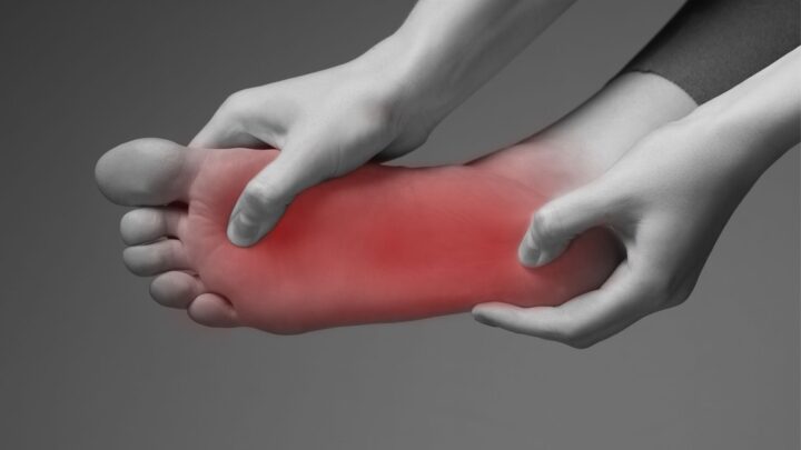 What Is a Fallen Arch and How Is It Treated? | Alexander Orthopaedics